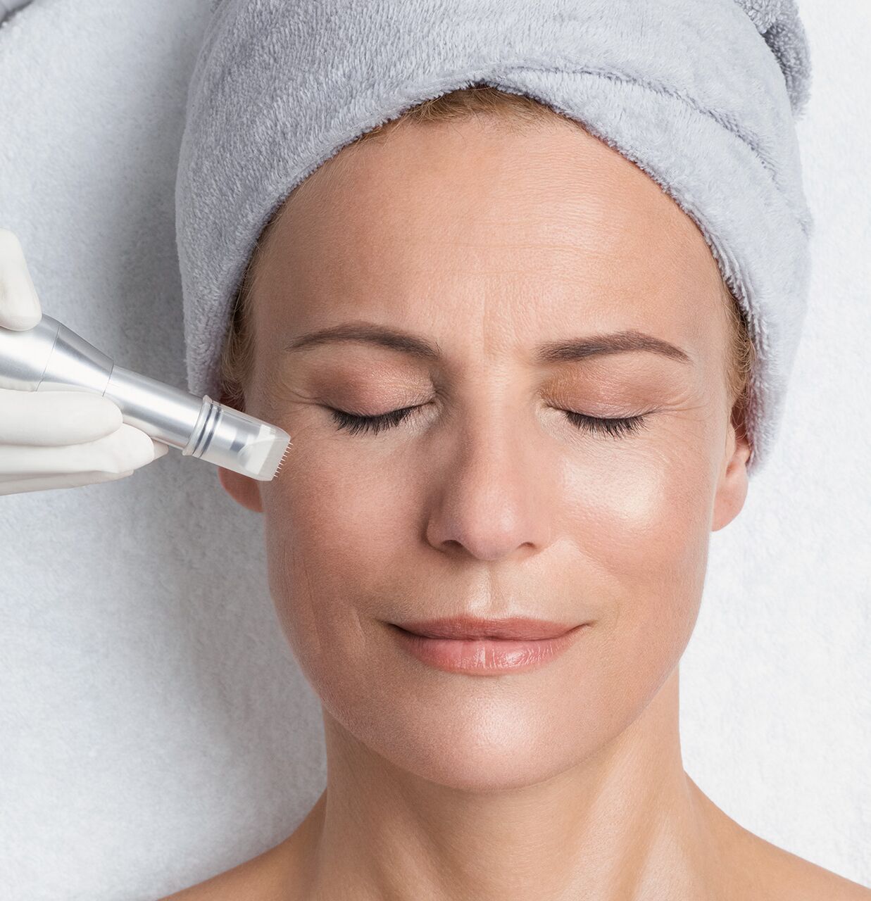 Micro-Needling – Kosmetische Behandlung - Institut für Kosmetische Medizin